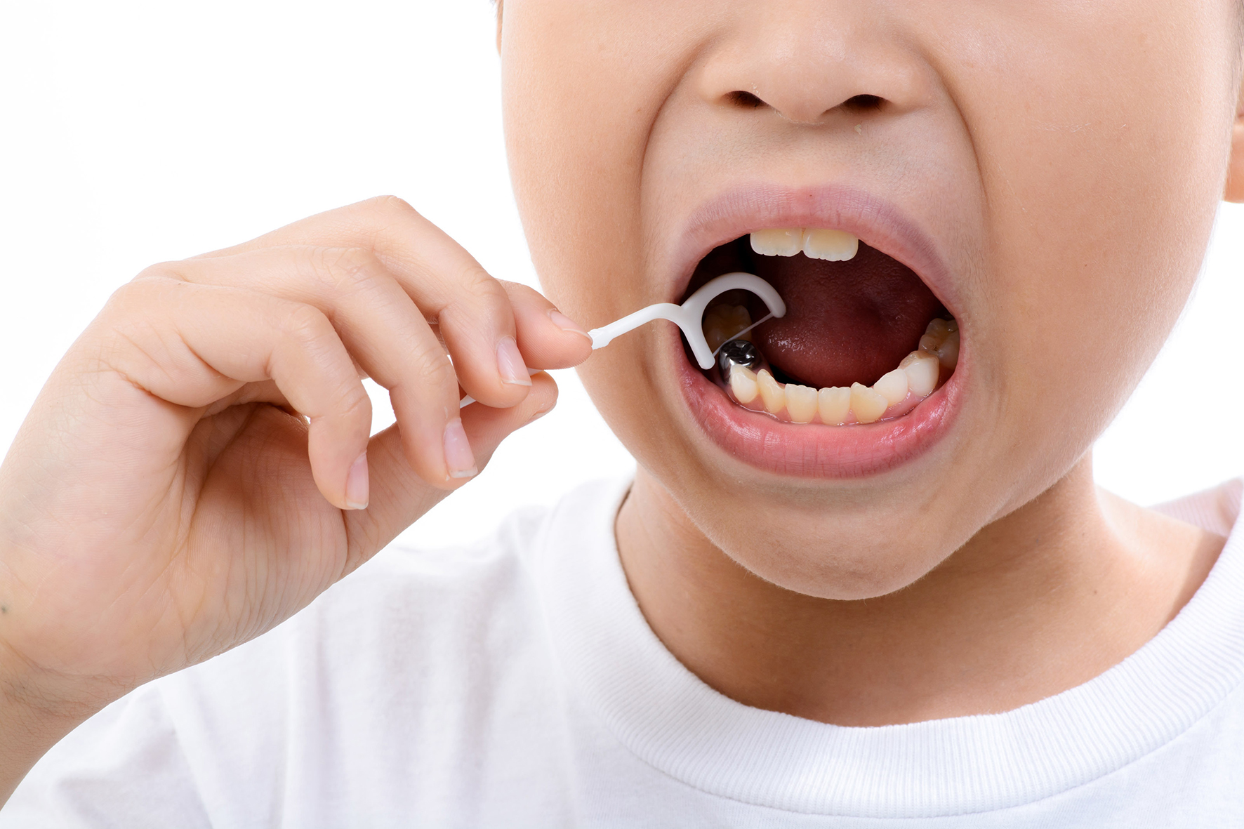 6 Year Old Molars And How To Help During Their Eruption Kiddies
