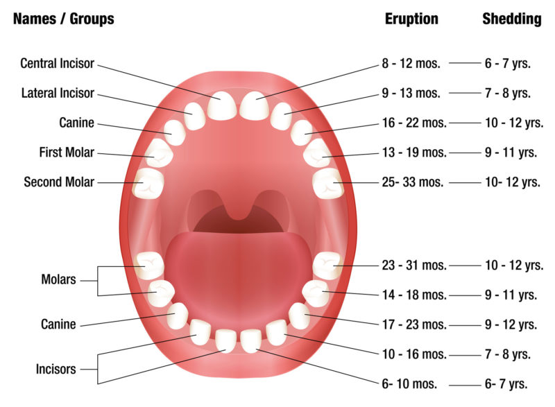 What are SHARK TEETH and should I be worried? - Kiddies Dental Care